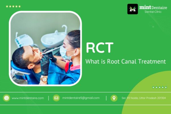 What is rct in dental treatment - Mint Dentaire